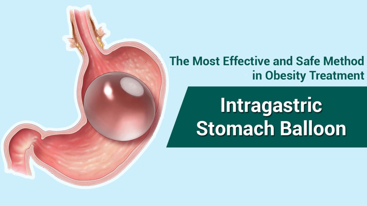 Stomach Balloon - Kaş Tıp Merkezi